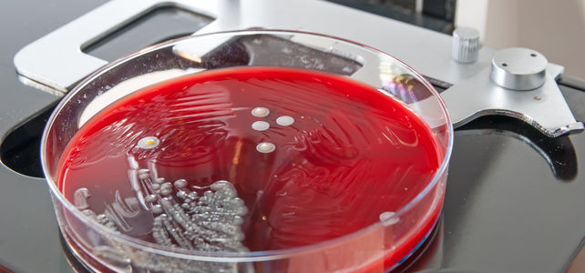 Multiresistente Keime: Phagen-Therapie macht Fortschritte